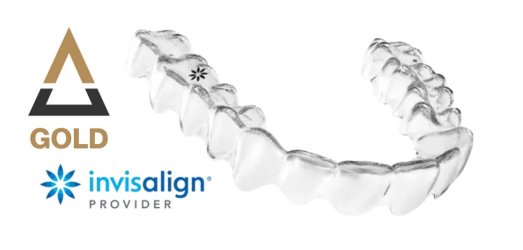 West Edmonton Dentist: Highly-Rated and we follow the Alberta Fee Guide